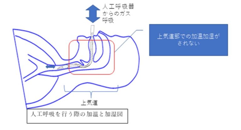 人工呼吸器と加温加湿器について解説！ 加温加湿器com