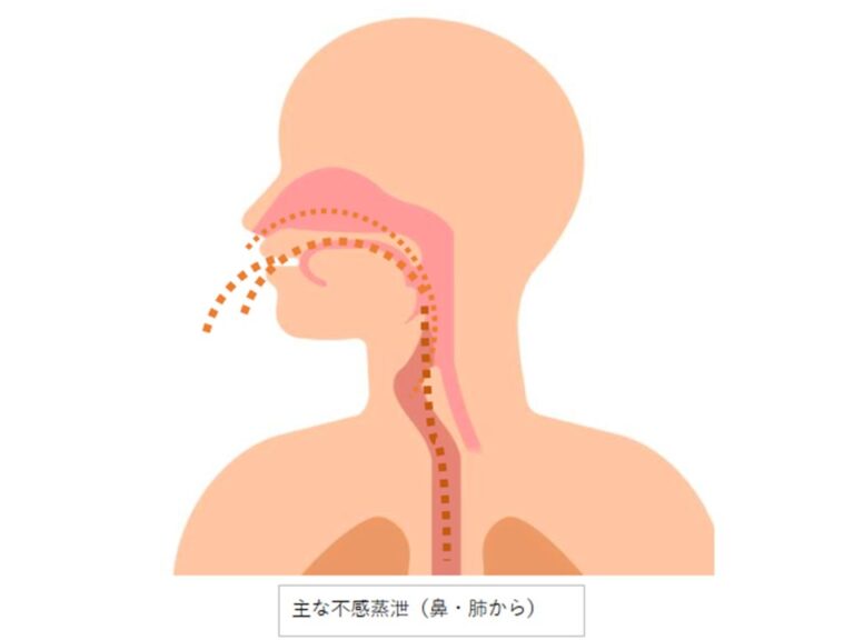 【よくわかる！加温加湿入門 Part6 】人工呼吸管理で加温・加湿が必要な理由～加湿不足により、気道や肺でなにが起こるか考えてみよう Vol