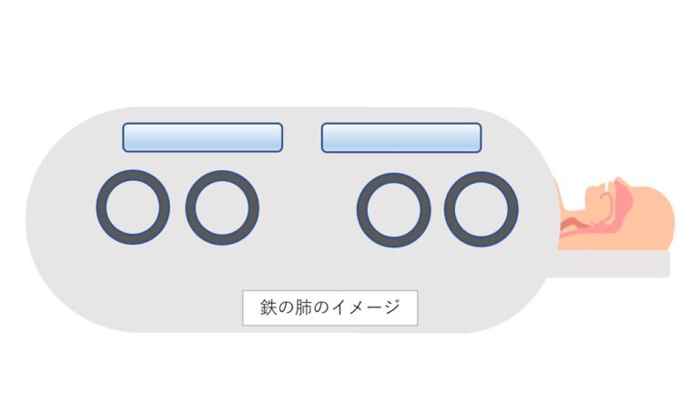 【よくわかる!加温加湿入門 Part5 】人工呼吸管理で加温・加湿が必要な理由~人工換気や換気補助の方式から考えてみよう~ 加温加湿器com
